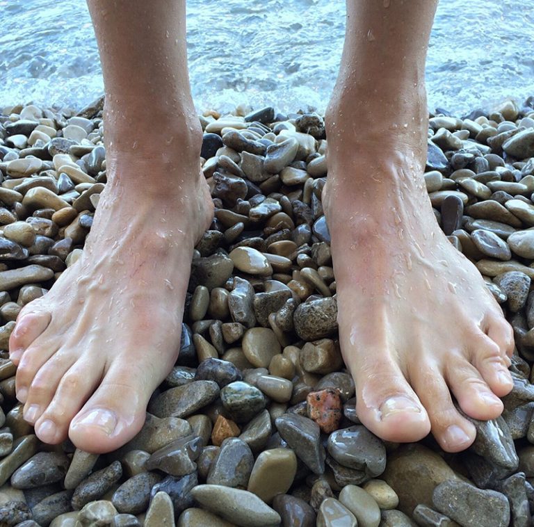 Flat Feet - Surrey Foot Service Ltd